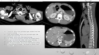 Tracheobronchial Injury | PPTX