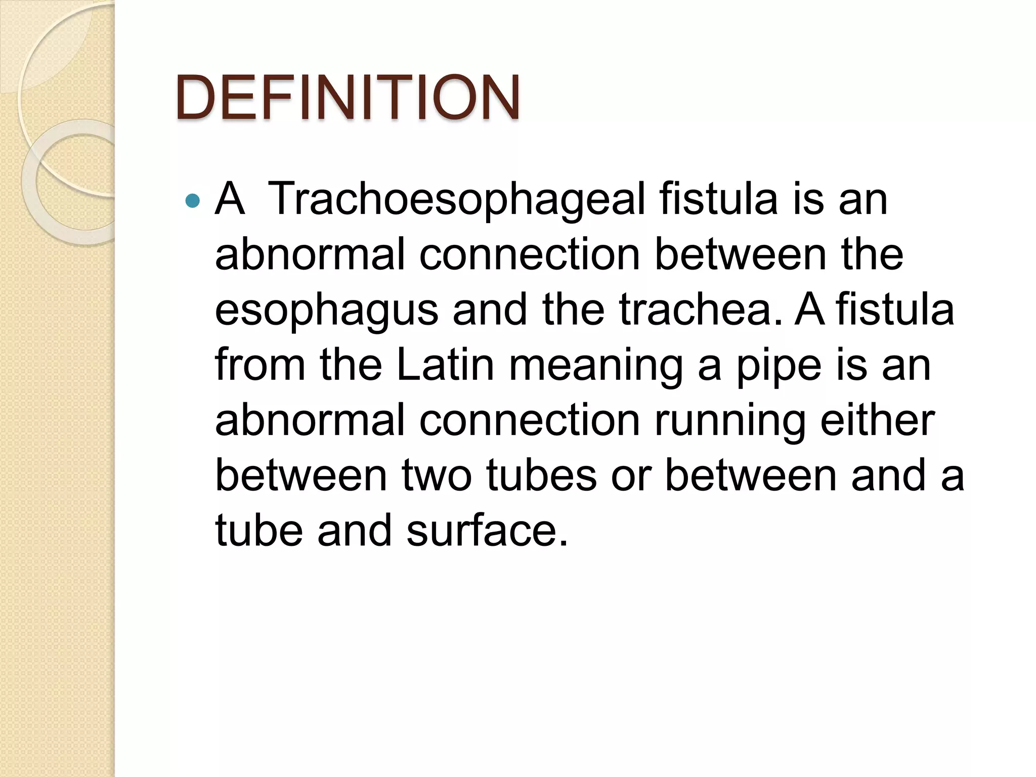TRACHEOESOPHAGEAL FISTULA | PPTX