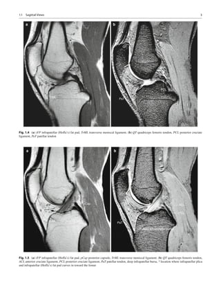 Niitsu magnetic resonance imaging of the knee | PDF
