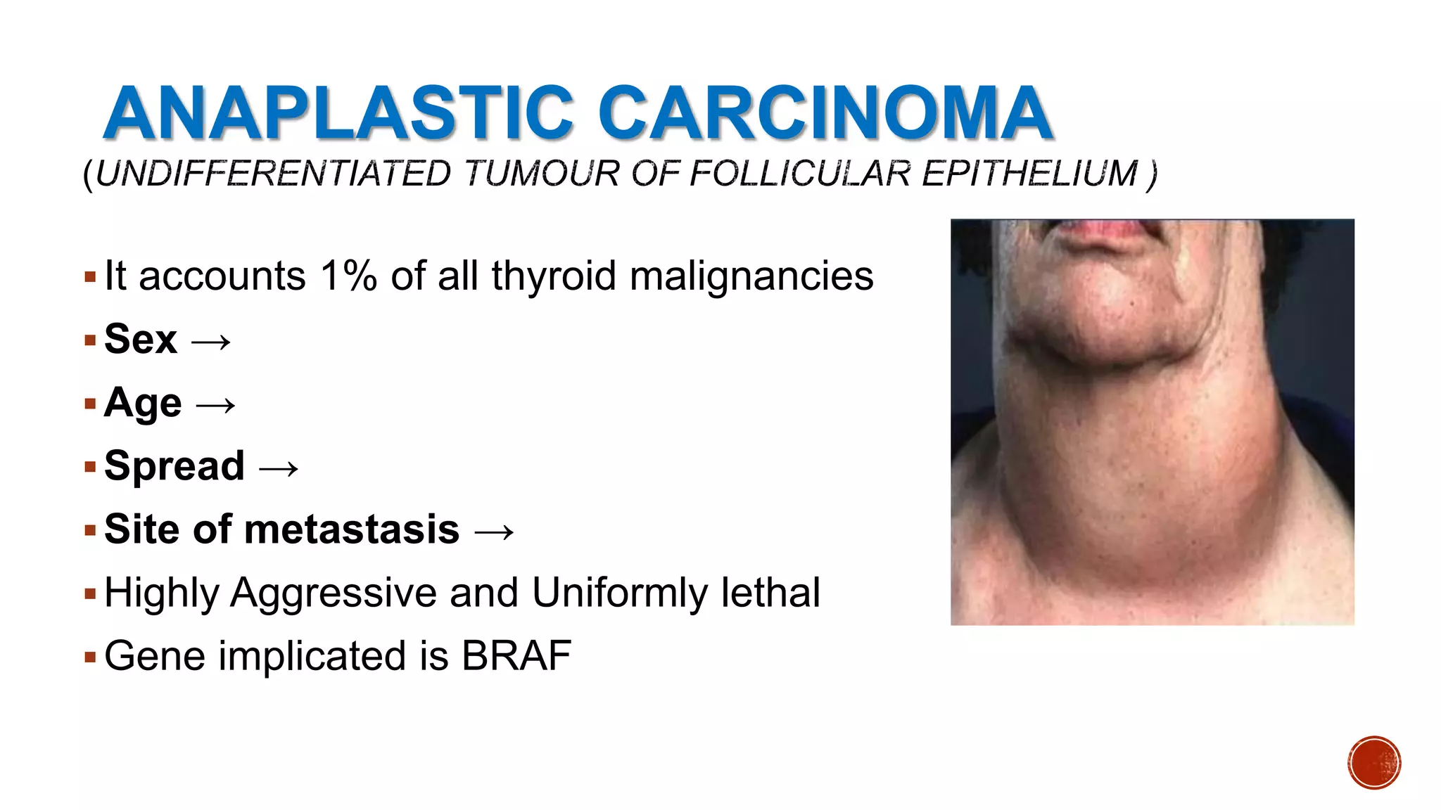 pathogenesis of thyroid carcinoma | PPTX