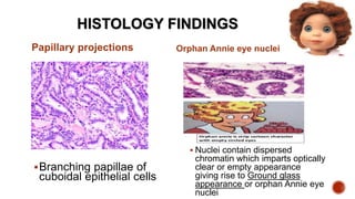 pathogenesis of thyroid carcinoma | PPTX