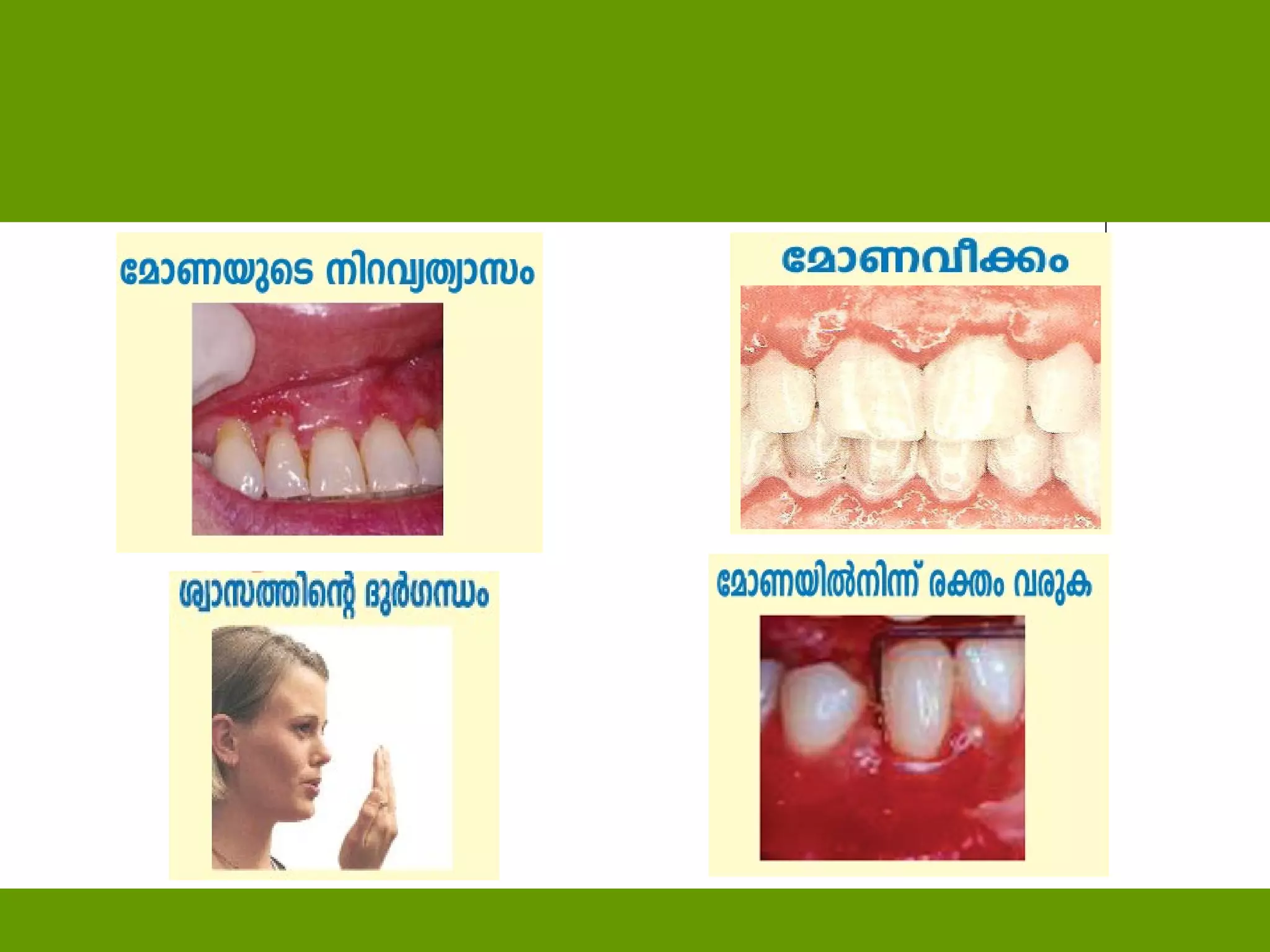 community health talk 1 | PPT