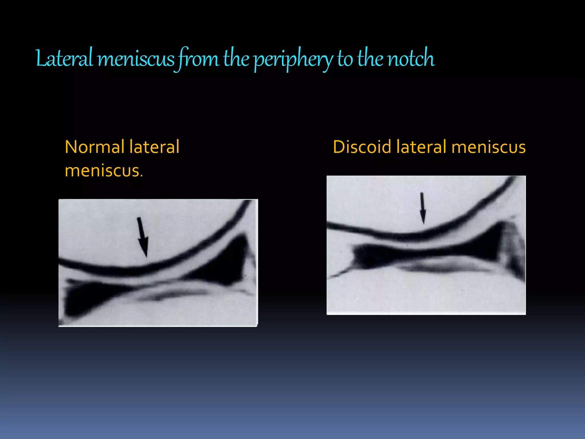 MRI KNEE JOINT ANATOMY | PPTX