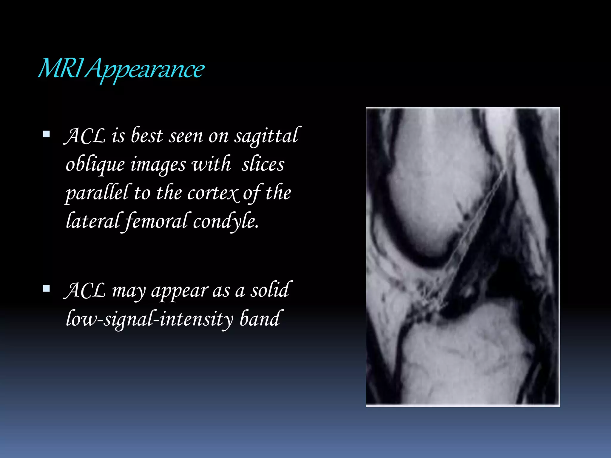 MRI KNEE JOINT ANATOMY | PPTX