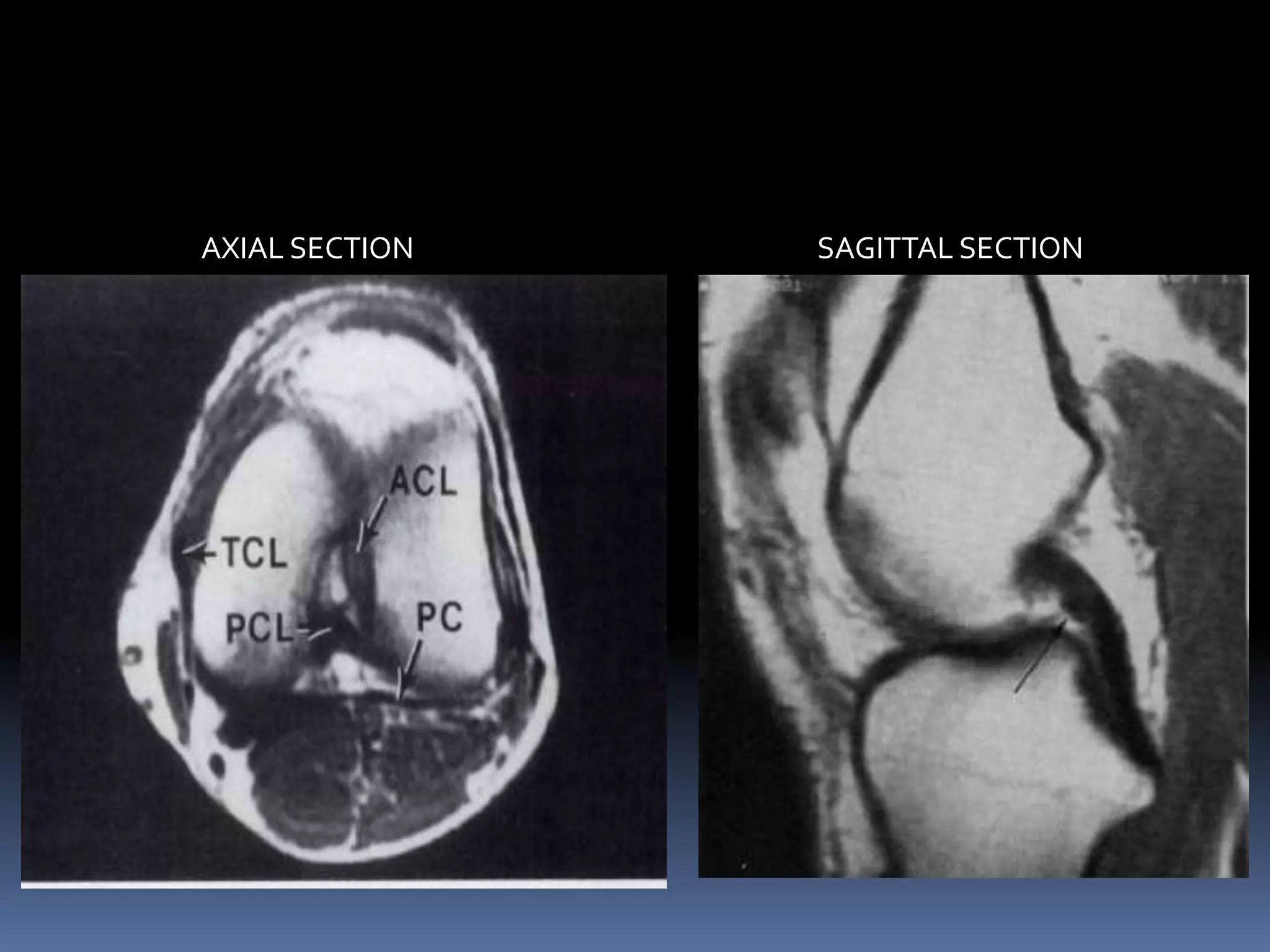 MRI KNEE JOINT ANATOMY | PPTX