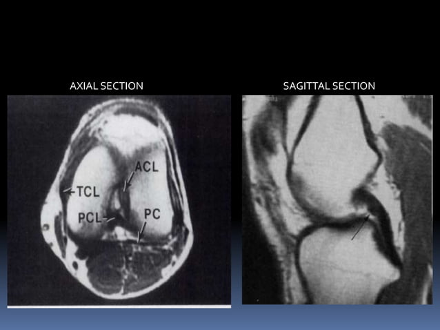 MRI KNEE JOINT ANATOMY | PPTX | 3-D Graphics | Computer Software and ...