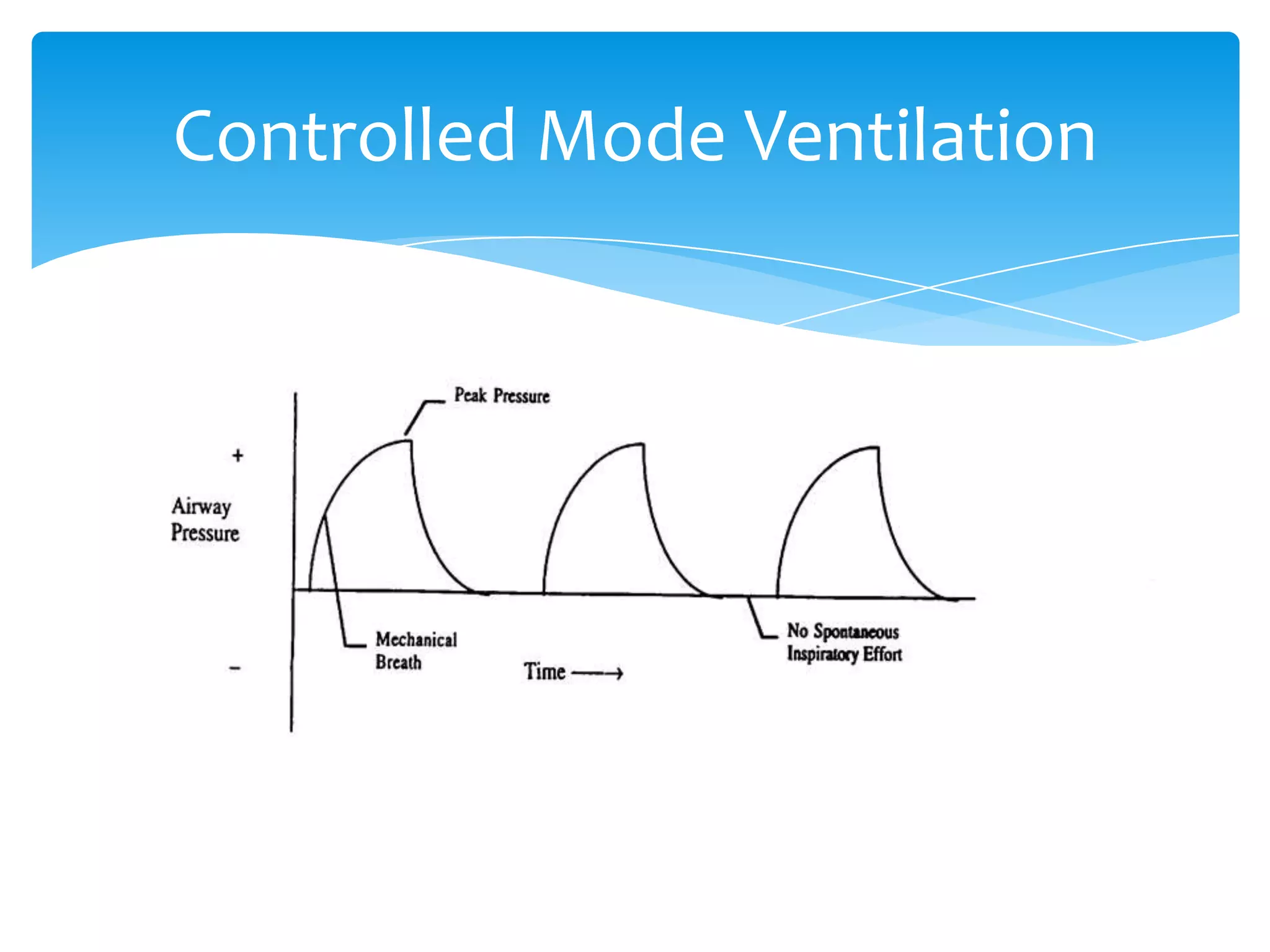 modes of ventilation | PPTX