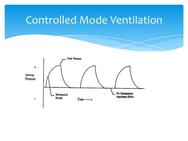 modes of ventilation