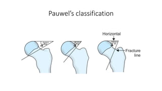 Nikhils ppt orthopedics | PPTX