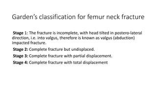 Nikhils ppt orthopedics | PPTX