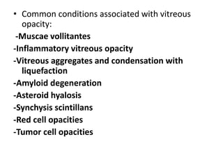 Asteroid Hyalosis Vs Synchysis Scintillans