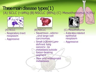 Lung cancer | PPT