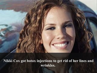 Nikki Cox Botox
