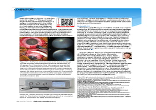 Nikolakopoulos 25+ 27 g evolution in bimanual primary vitrectomy for rd ...