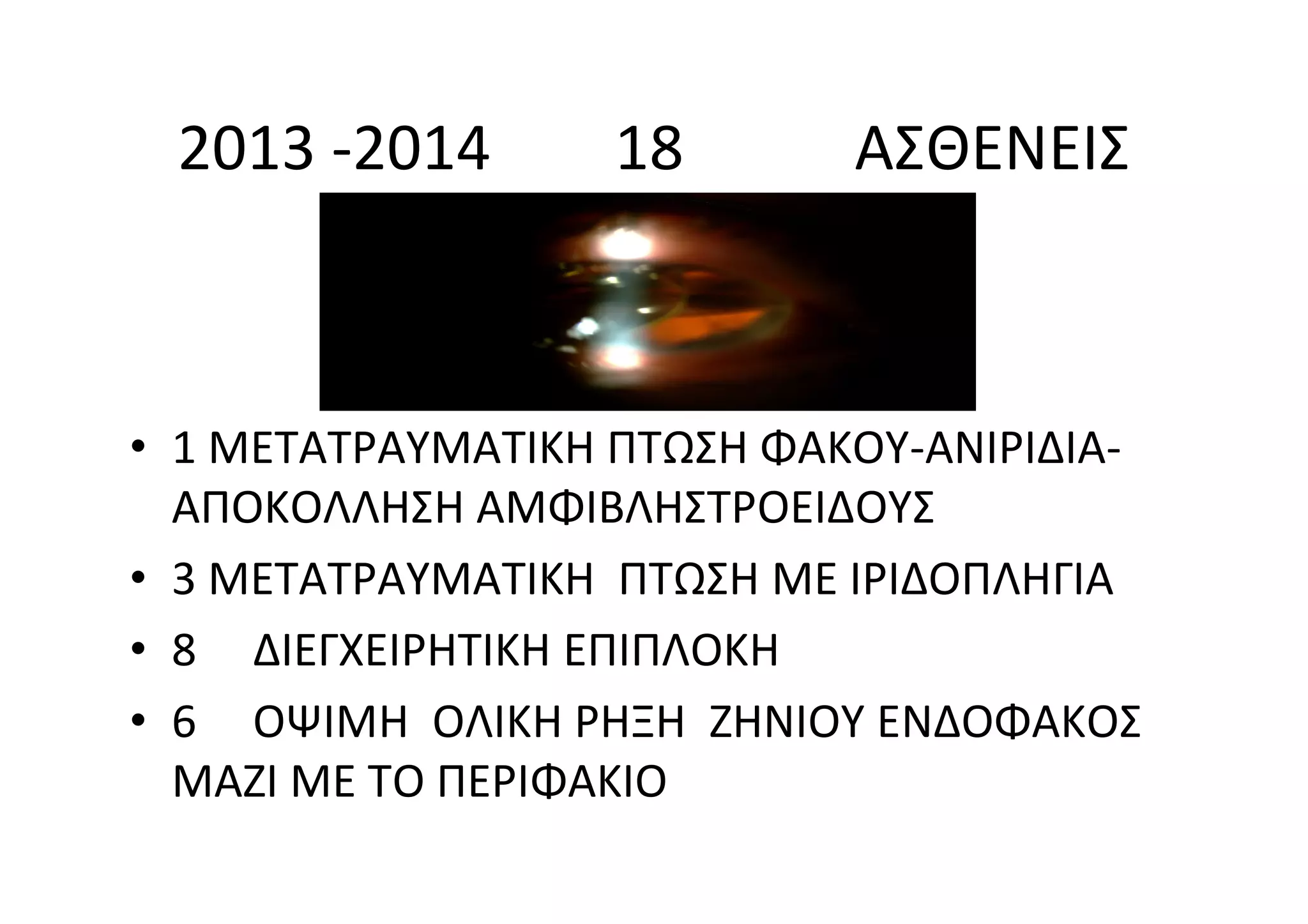 Nikolakopoulos endoscleral iol | PPT