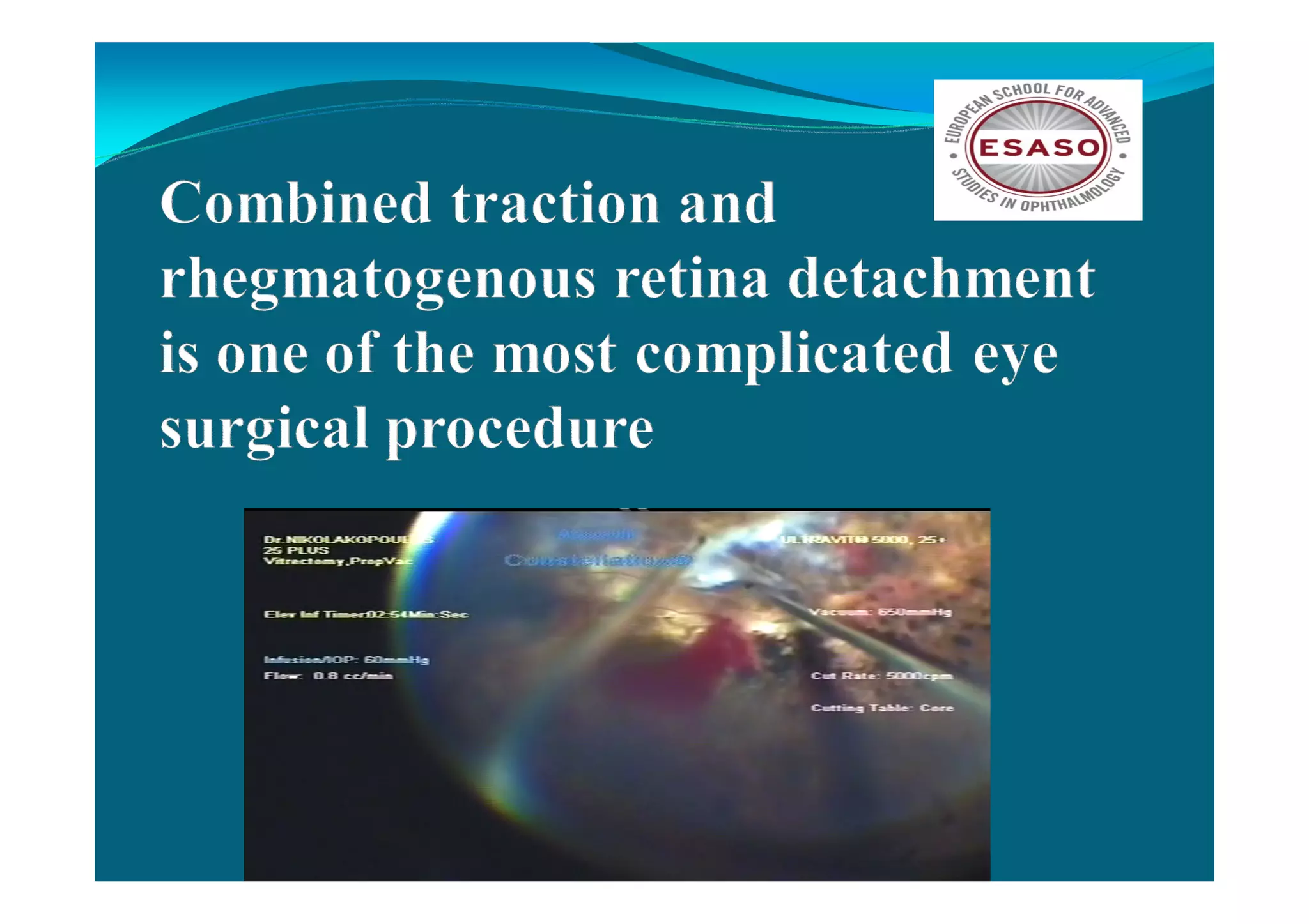 Nikolakopoulos esaso traction rd | PDF