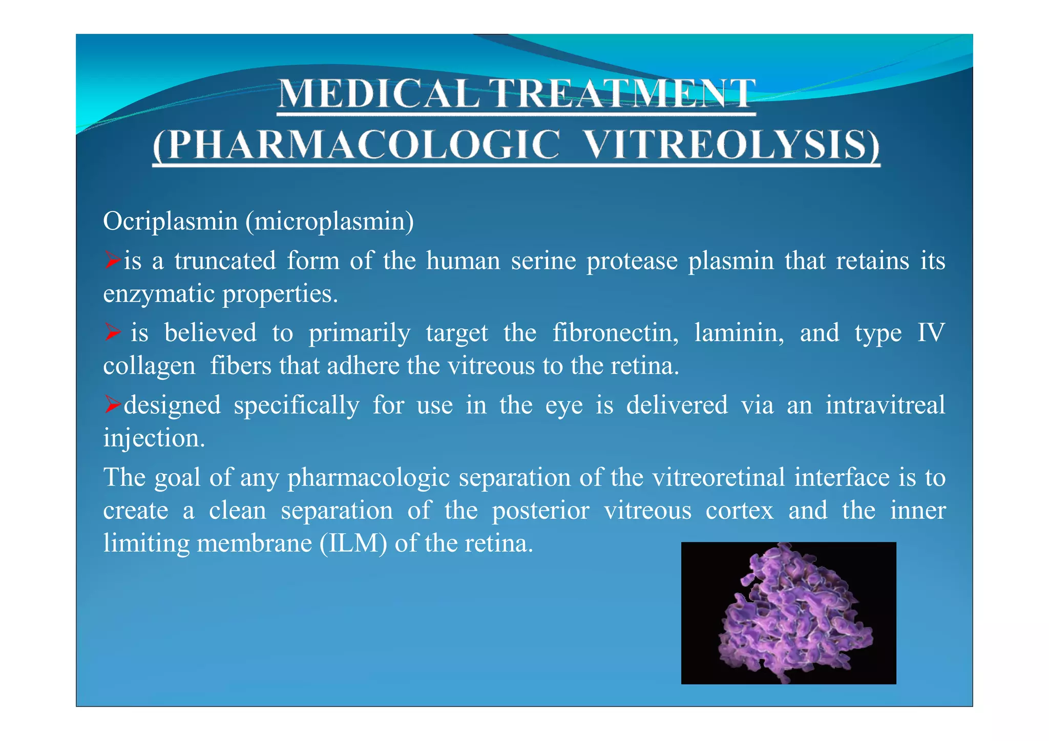 Nikolakopoulos vitrectomy or microplasmin in dme with vitreomacular ...