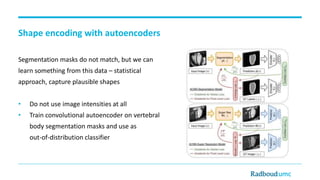 Learning-based vertebra segmentation, identification and partioning | PPTX