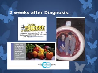 Colon Cancer Presentation - My Impact Story | PPTX