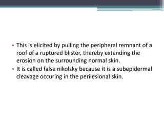 Nikolsky sign | PPTX