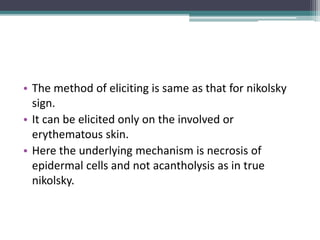 Nikolsky sign | PPTX
