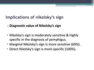 Nikolsky sign | PPTX