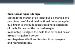 Nikolsky sign | PPTX