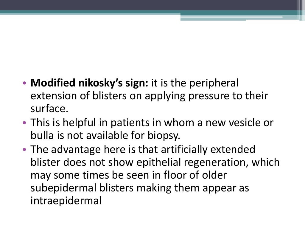Nikolsky sign