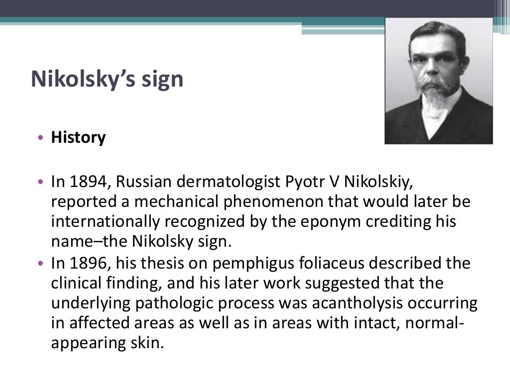 Nikolsky sign