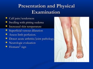 seminar on deep venous thrombosis | PPT