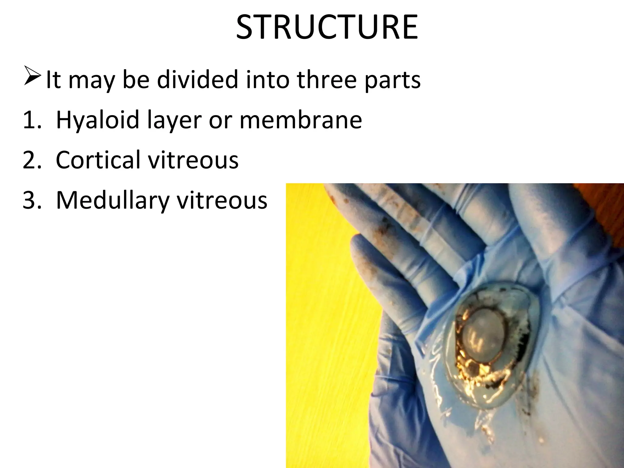 Vitreous humour | PPT