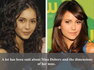 Nina Dobrev Before And After