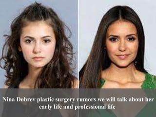 Nina Dobrev Before And After