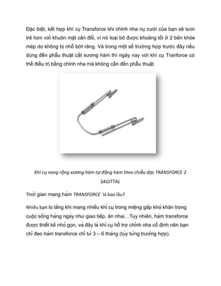 Niềng răng không cần nhổ răng | DOC