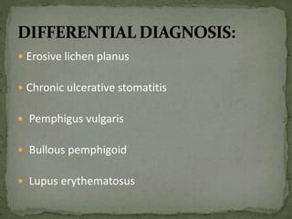 Desquamative Gingivitis | PPTX