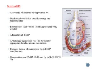 Nipah_Training-PPT-for-Medical-Officers-1.pdf