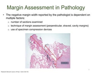 Margin of Breast Conservative Surgery - How much is enough_.pptx