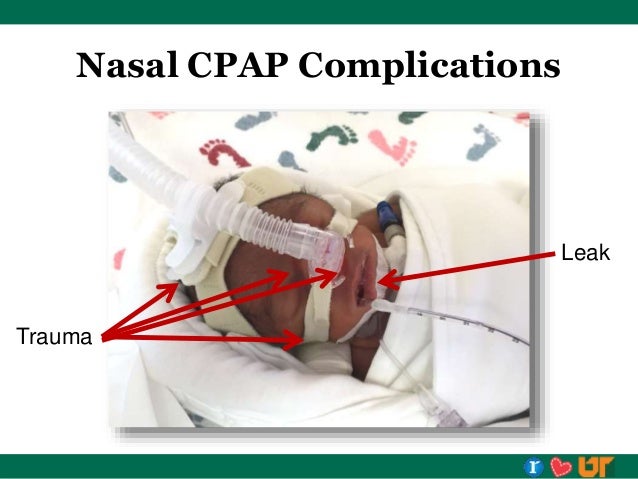 Non-Invasive Ventilation for Preterm Infants