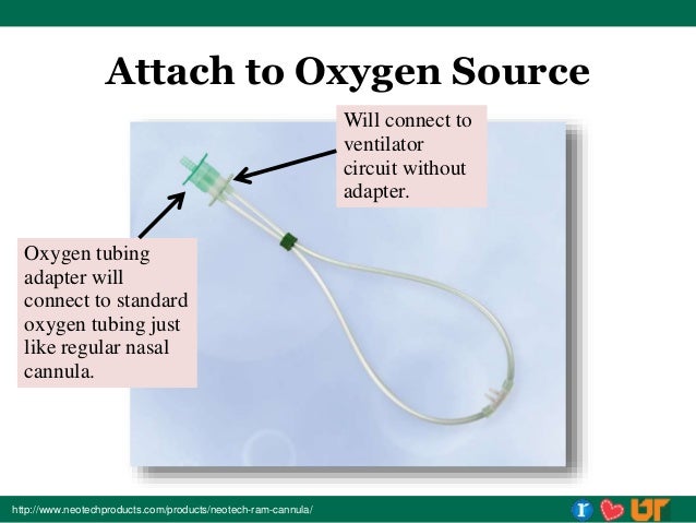 Neotech Ram Infant Nasal Oxygen Cannula Orange 10box Ring Settings: