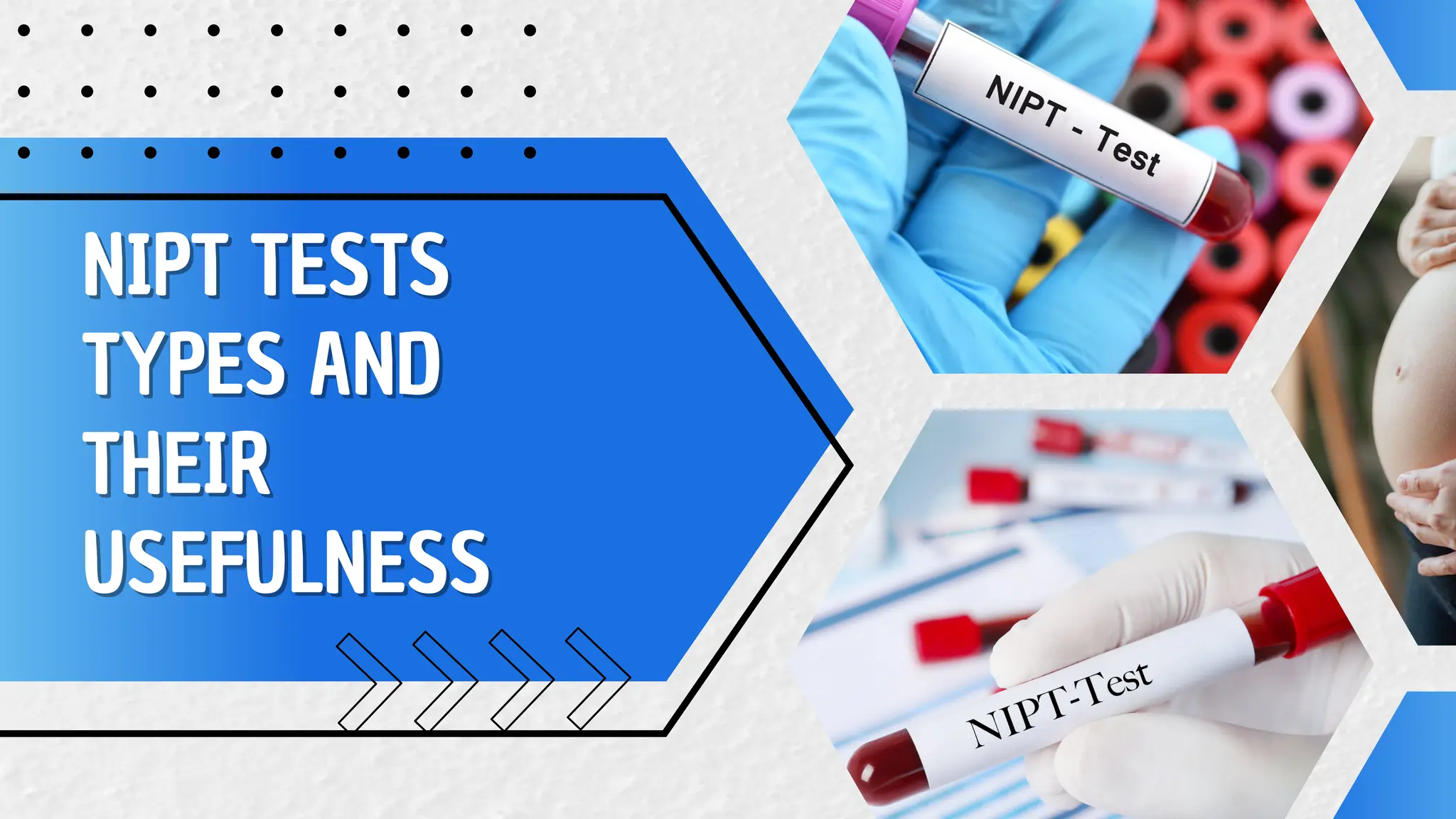 NIPT Tests Types And Their Usefulness | PDF