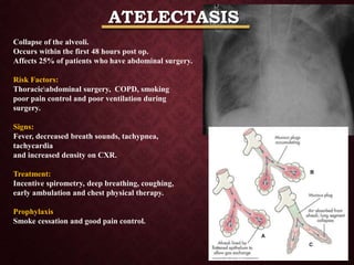 Post-operative care by Dr Nipun Bansal | PPT