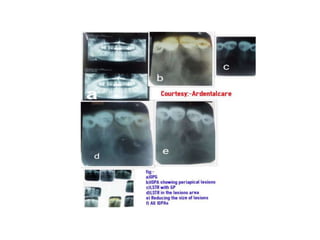 LSTR 3mix MP important efficacy particularly antibacterial and ...
