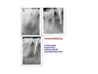 LSTR 3mix MP important efficacy particularly antibacterial and ...