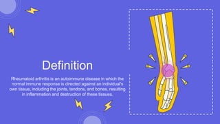 RHEUMATOID ARTHRITIS | PPTX