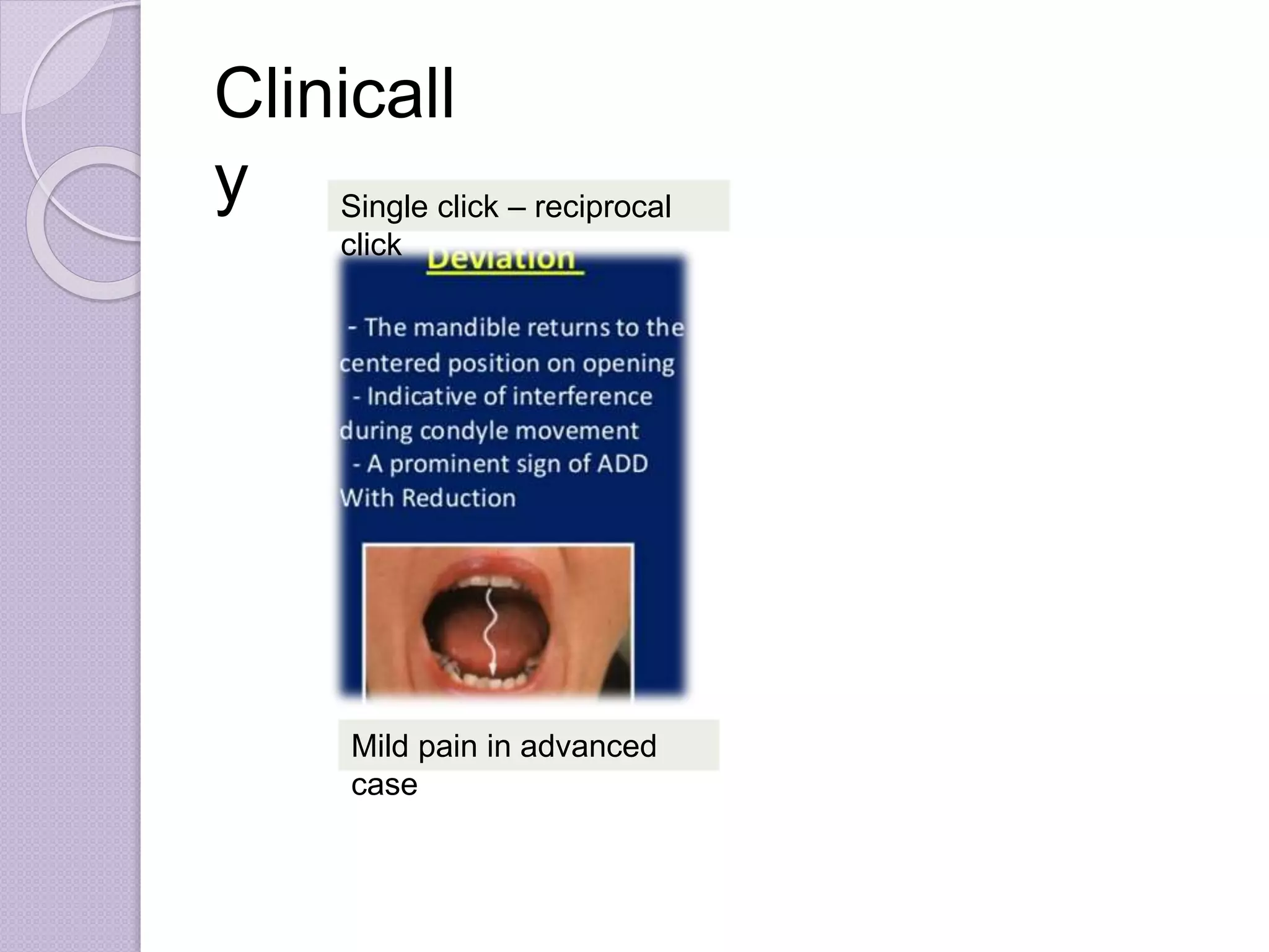 Tmj Temporomandibular Joint Disorders Ppt