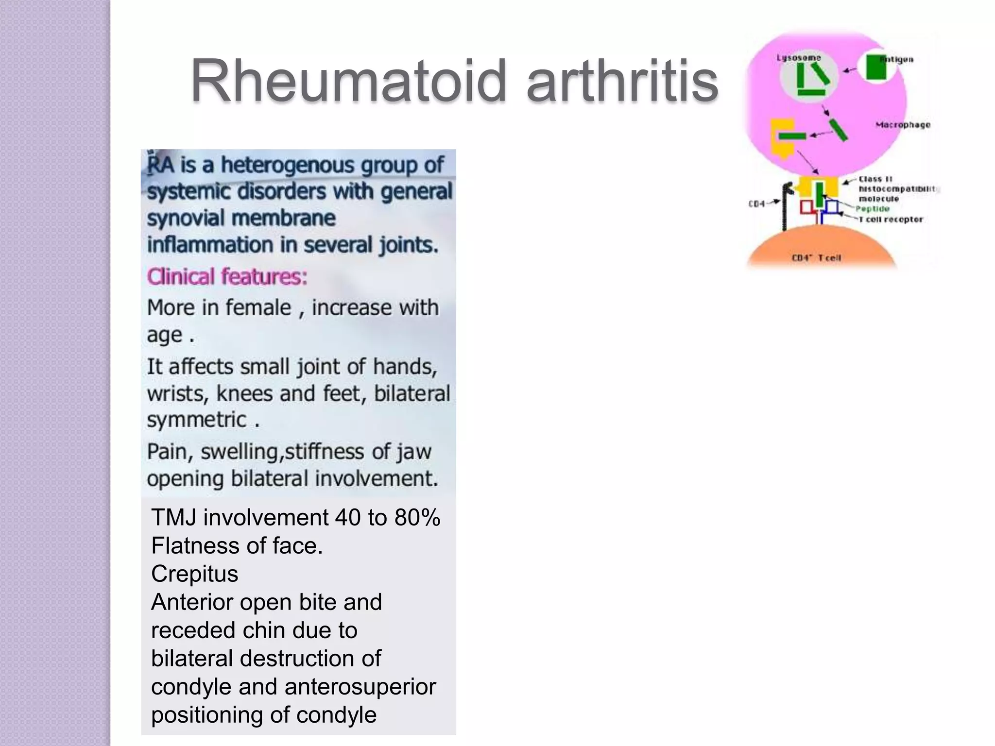 TMJ (temporomandibular joint) disorders | PPTX