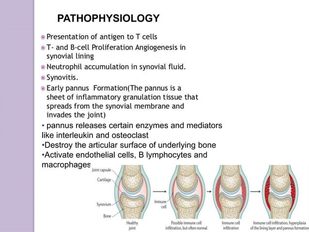 TMJ (temporomandibular joint) disorders | PPTX | Bone and Joint ...