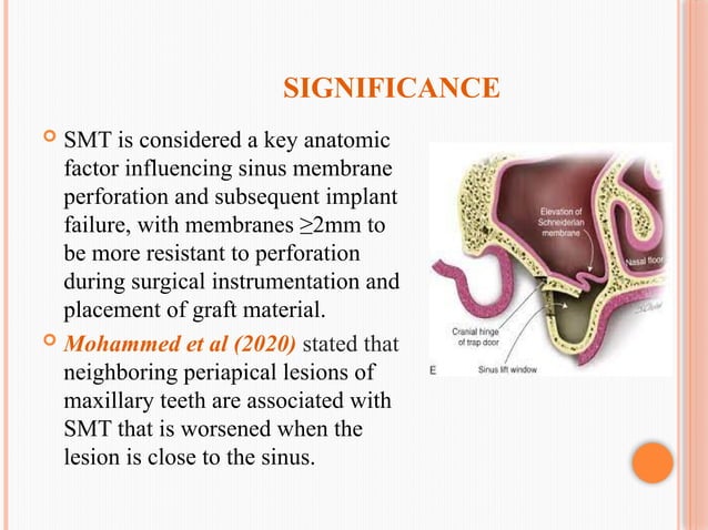 nitheesha maxillary sinus oresented.pptx