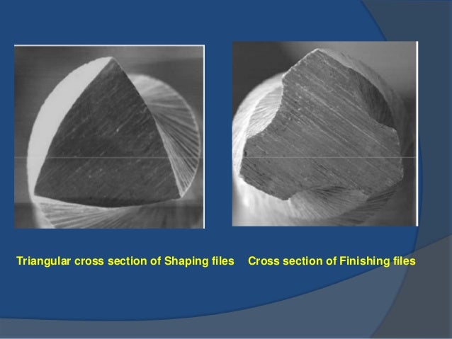 Nickel Titanium Instruments in Endodontics