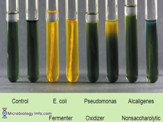 Nitrate reductase test and oxidation-fermentation test.pptx